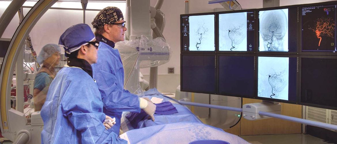 Thrombectomy – Get Ahead of Stroke