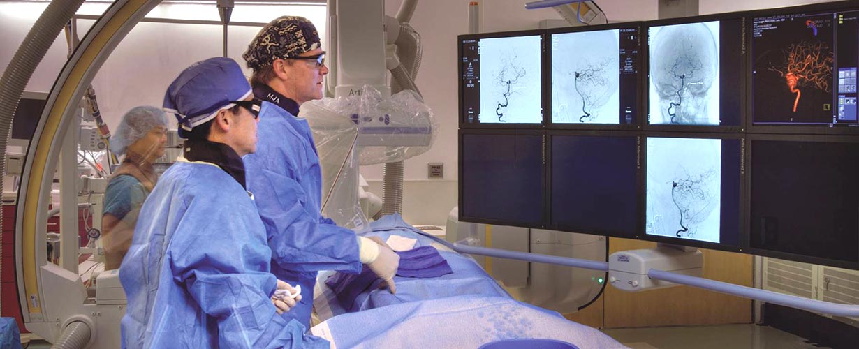 Thrombectomy – Get Ahead of Stroke